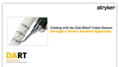 DART Direct Anterior Reconstructive Technology | Stryker