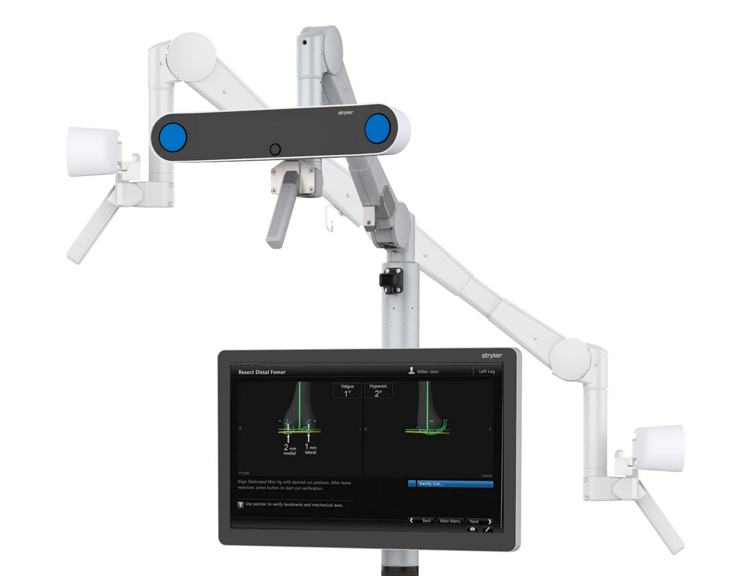 Ortho Q Guidance system | Stryker Ortho Q Guidance system | Stryker