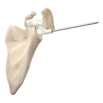 Trauma & Extremities | Stryker