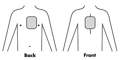 AED pad placement guide | Stryker